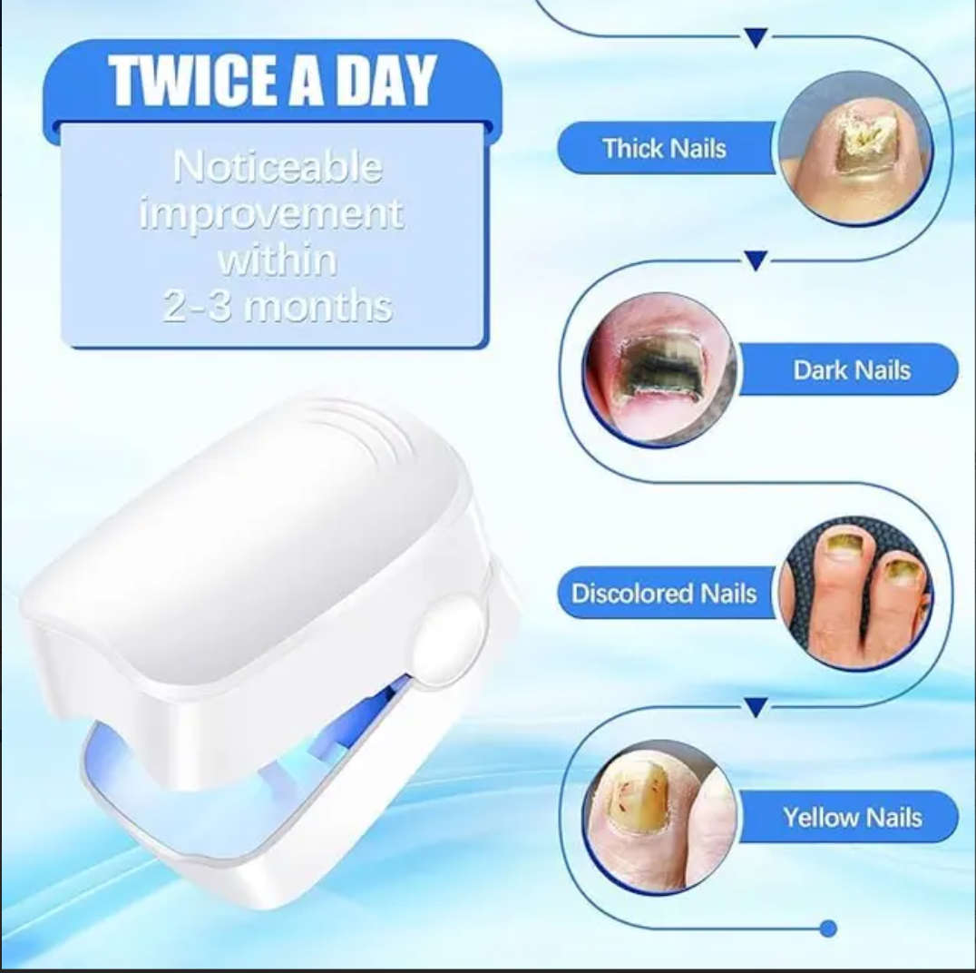 Anti Fungal Laser Device, Nail Treatment for Toenail,7-Minute Fast ...